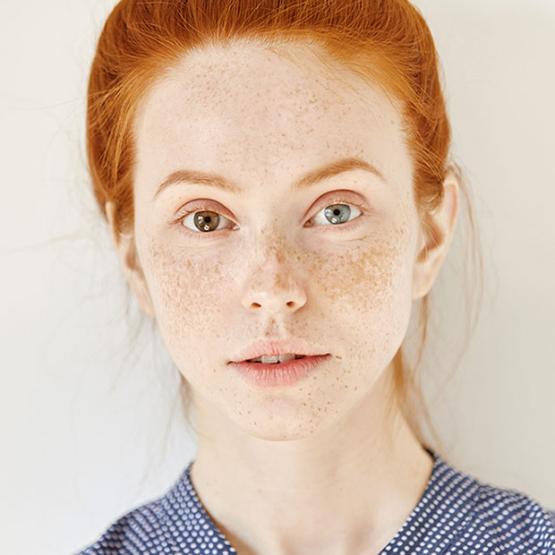 What Do You Know About Heterochromia? – Lafayette CA | Jeremy Ensor, O.D.